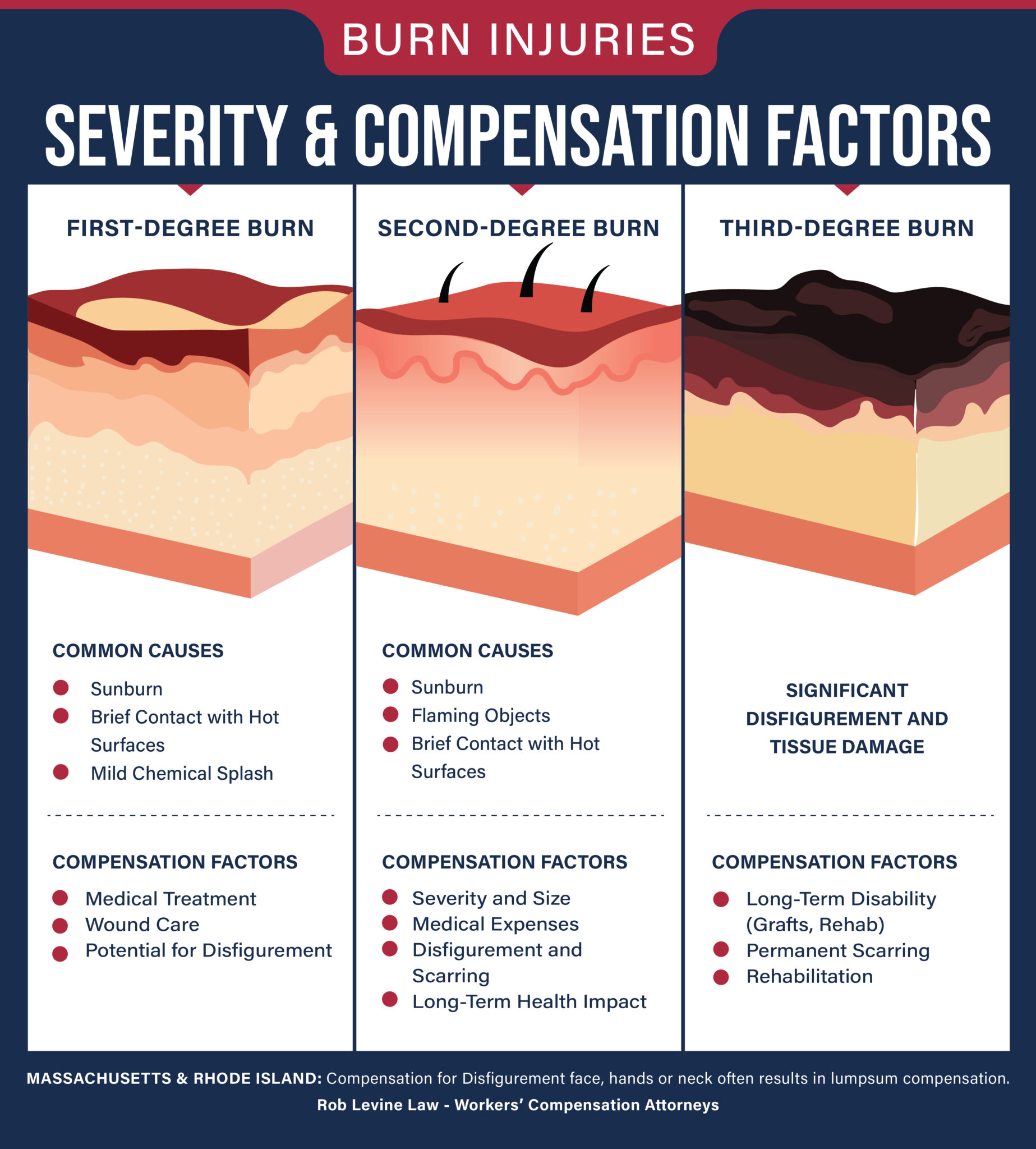 Are Burn Injuries Covered Under Workers’ Compensation?